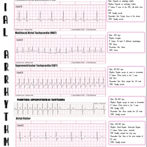 EKG Need to Knows/ Nursing/ EMT- Paramedic/ Cardiology - Etsy
