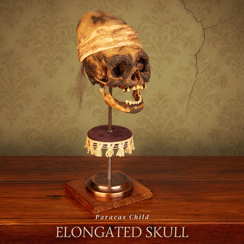 Realistic Human Skull Replica - Etsy