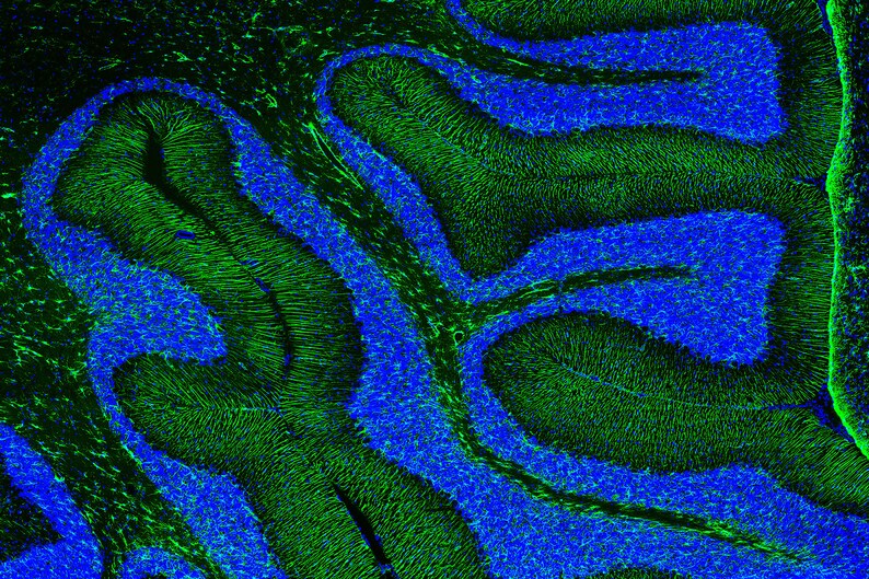 Brain Cell Wrapping Paper - Etsy