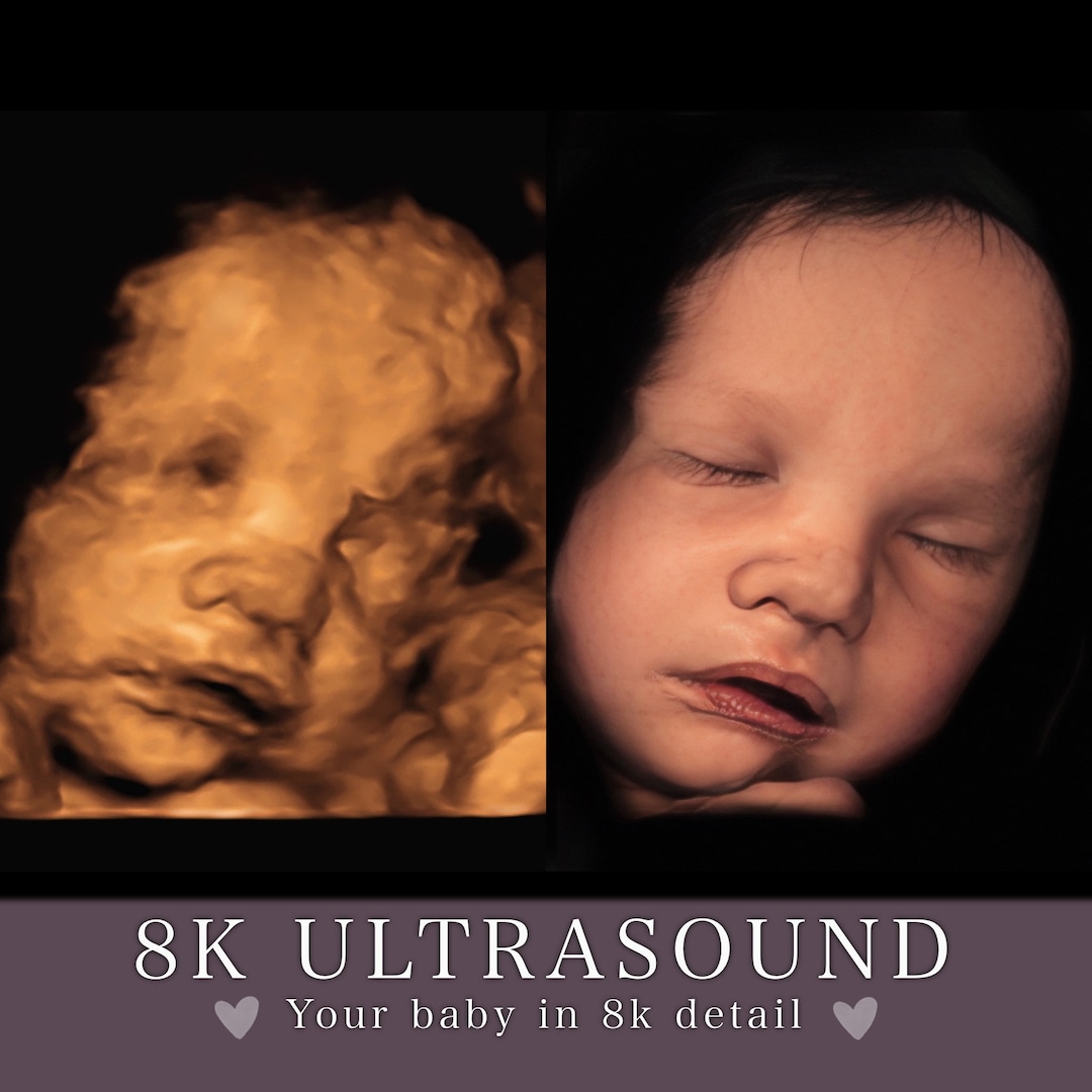 8k Ultrasound, 3d, 4d, 5d, Baby Ultrasound, Gift for New Mom, Baby ...
