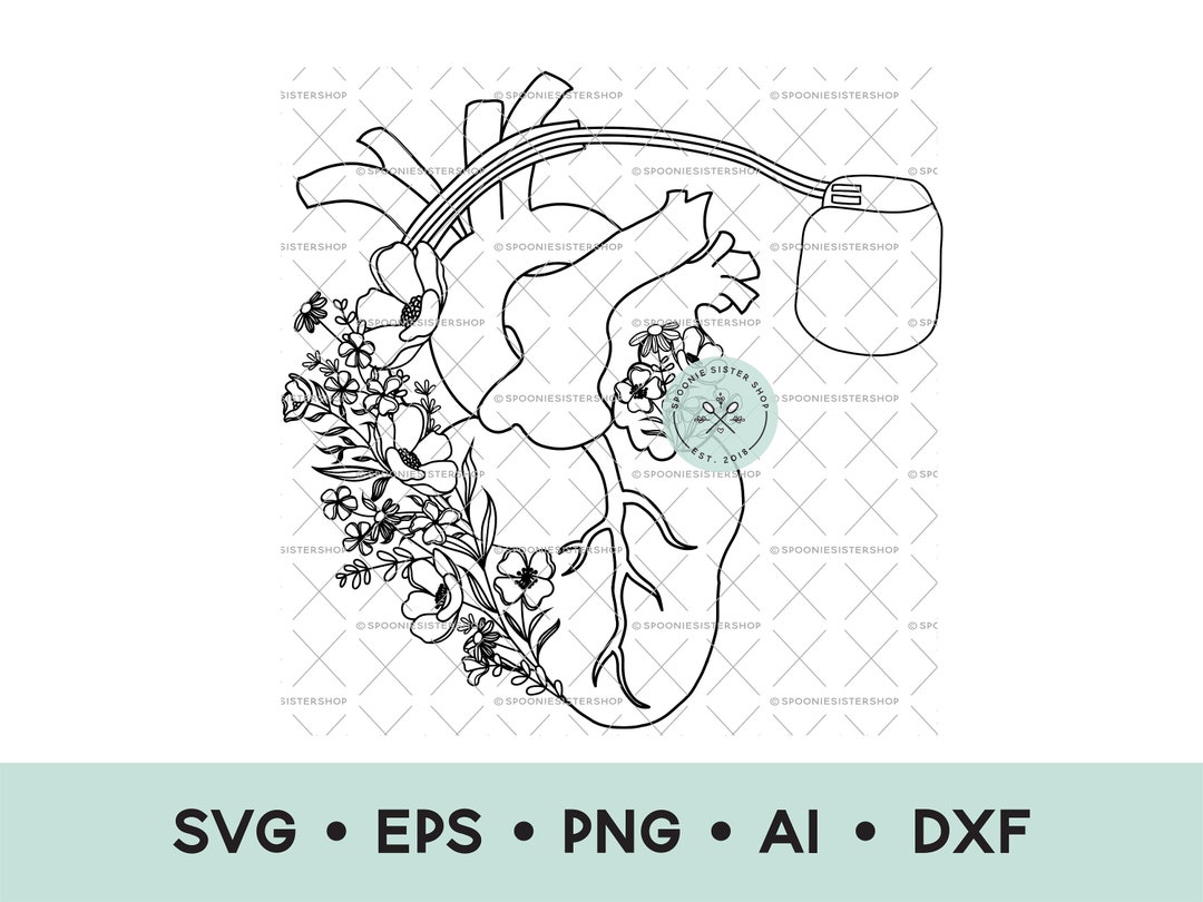 Heart Pacemaker Anatomy SVG, Cardiac Pacemaker PNG, Pacemaker Clipart ...