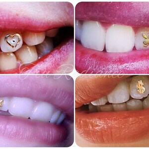 Solid 18k Gold & Rose Gold Tooth Charm Tooth Gem One Piece Gem Style ...