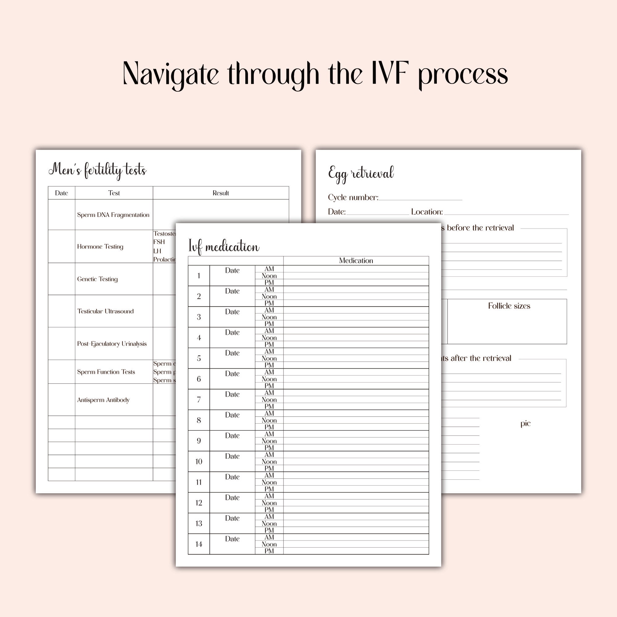 IVF Planner Printable, IVF Checklist, Fertility Planner, IVF Treatment ...