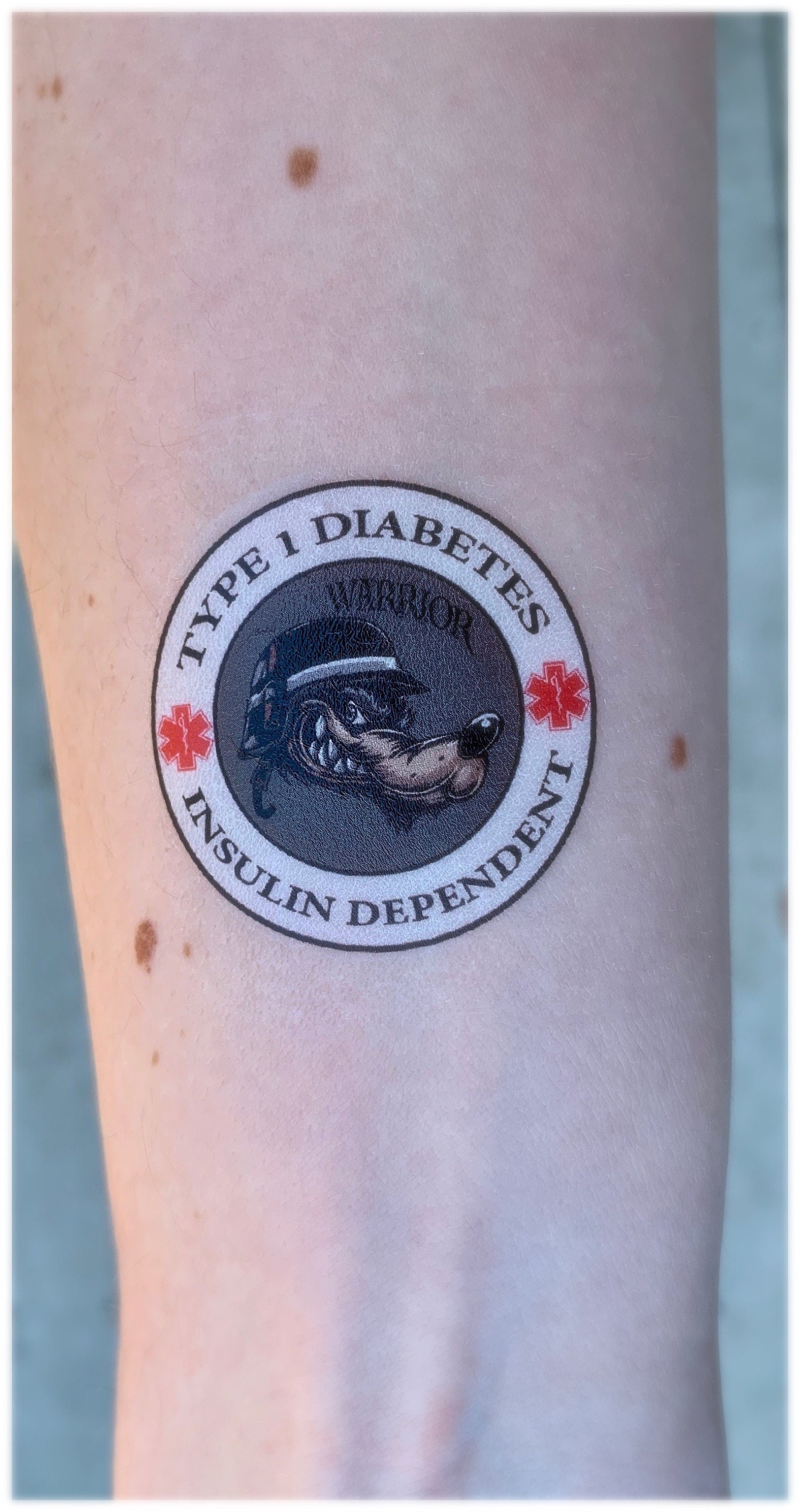 Type 1 Diabetes Insulin Dependent Medical Alert Temporary - Etsy