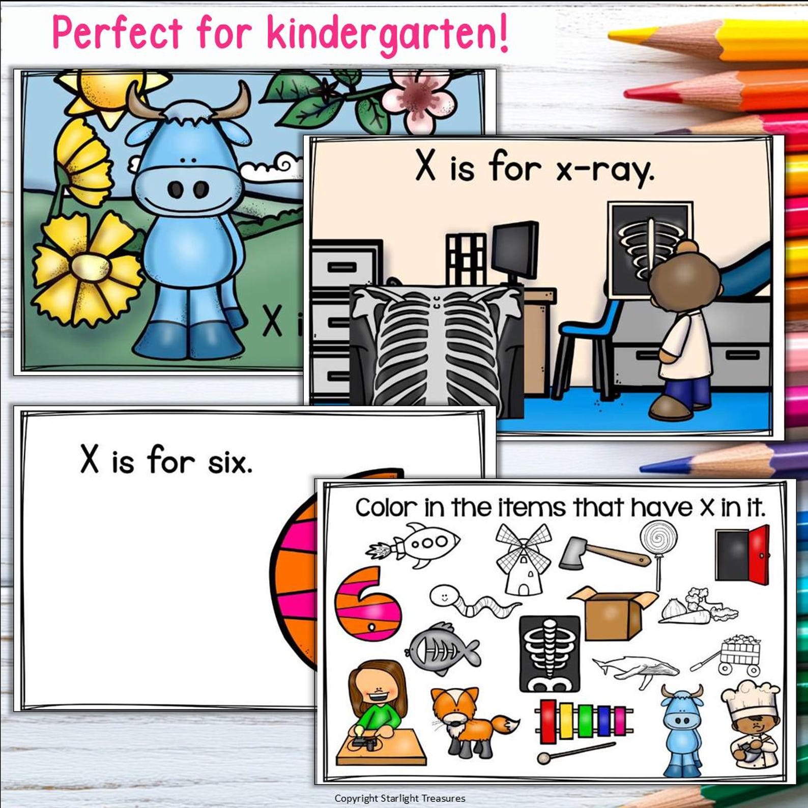 Letter X Mini Book - Alphabet Learning Activity (digital Download) - Etsy