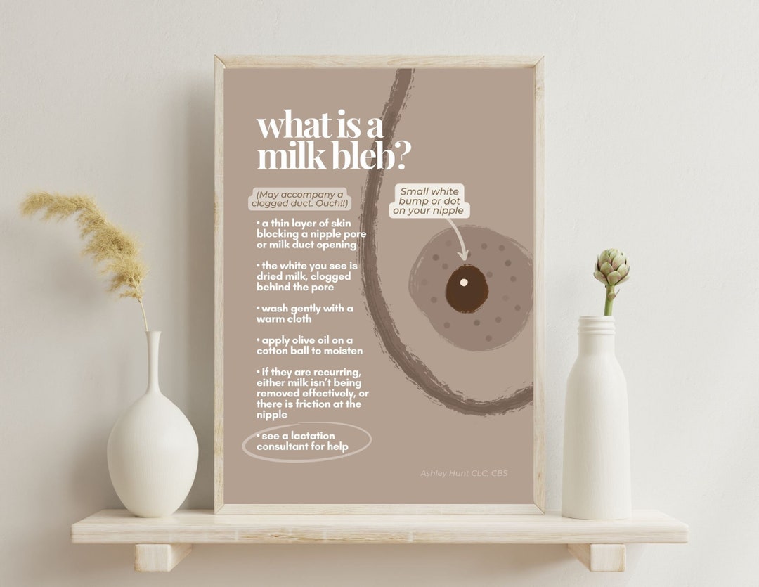 Milk Bleb Educational Print: Lactation Consultant Poster (digital ...