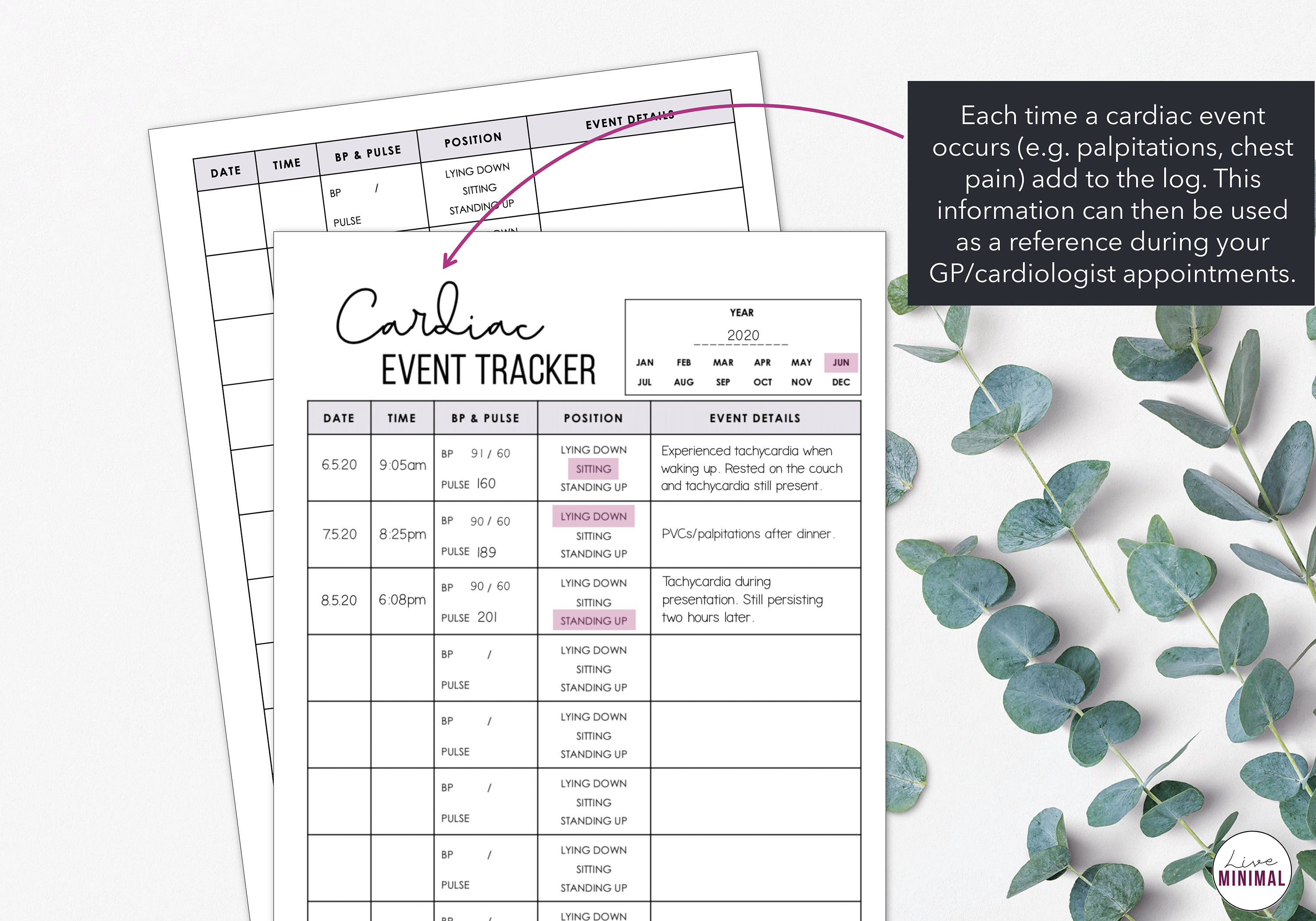 Cardiac Event Tracker Printable | Cardiac Event Log | Dysautonomia Log ...