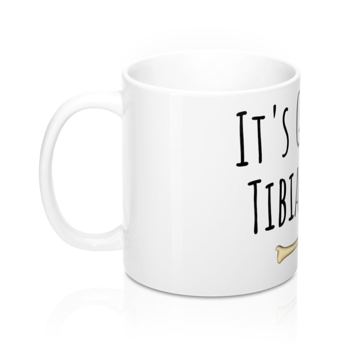 It's Going Tibia Okay - Anatomy Pun Get Well Soon Gift Mug 11oz - Etsy