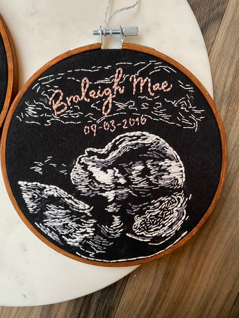 Custom Ultrasound Embroidery - Etsy