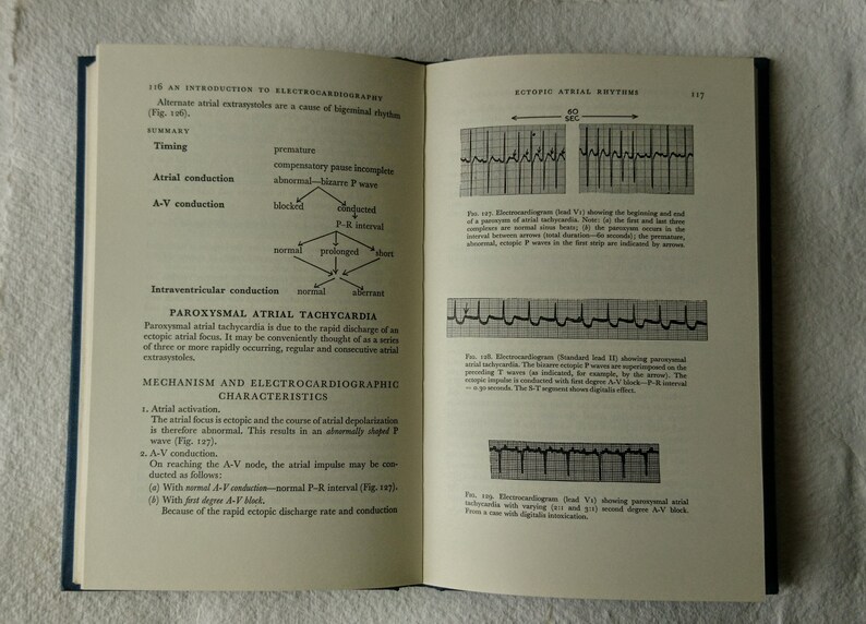 An Introduction to Electrocardiography L. Schamroth Oxford - Etsy