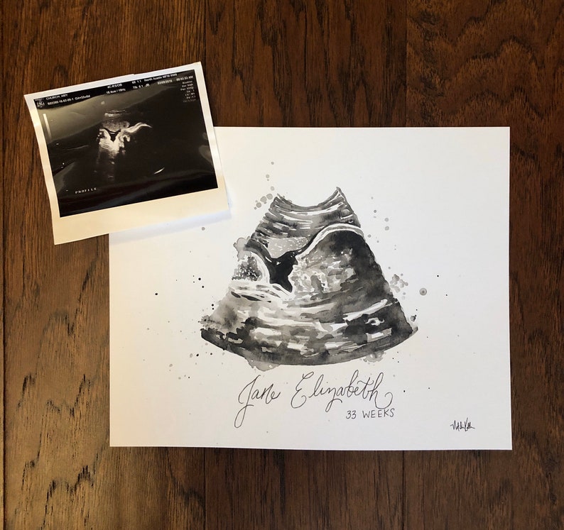 Custom Sonogram Portrait- Watercolor Ultrasound- Nursery Art- Baby Girl ...