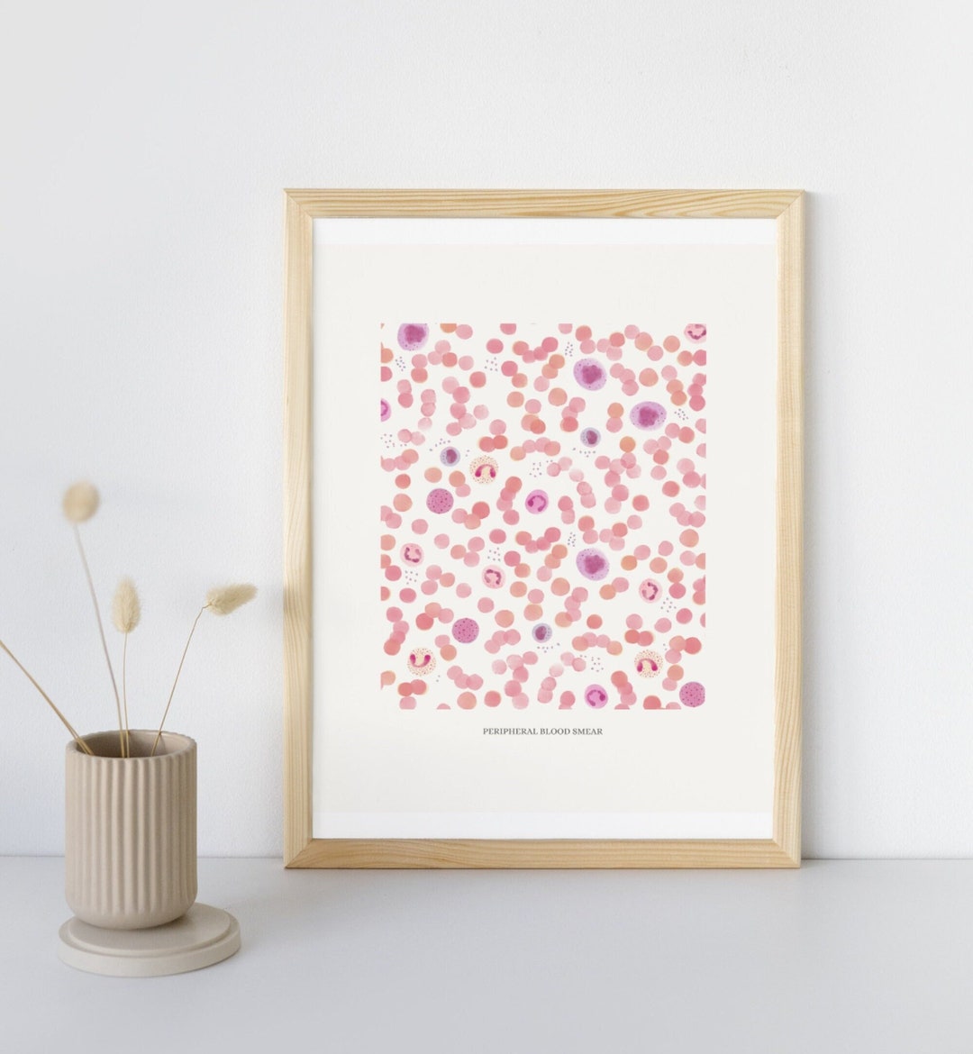 Peripheral Blood Smear Watercolor Art Print Anatomy Art Hematology Gift ...