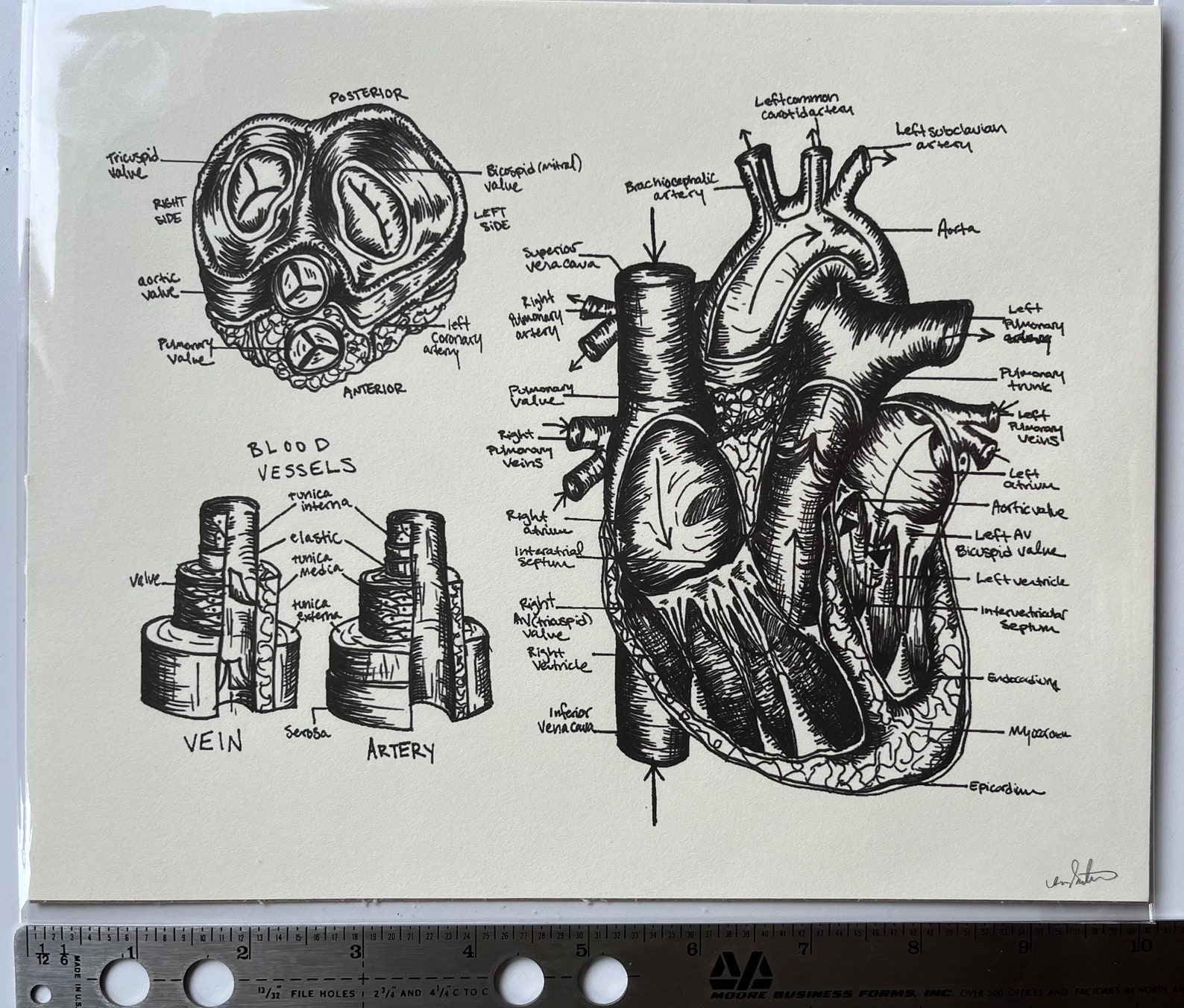Anatomical Heart Wall Art Print, Cardiac Anatomy Diagram, Vintage ...