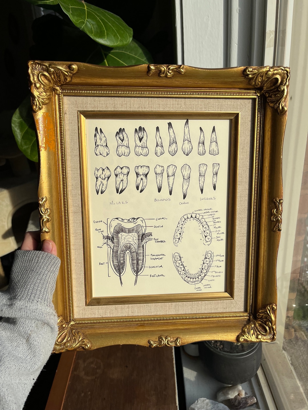 Dental Anatomy Art Print, Dental Wall Art, Dental Hygienist Gift ...