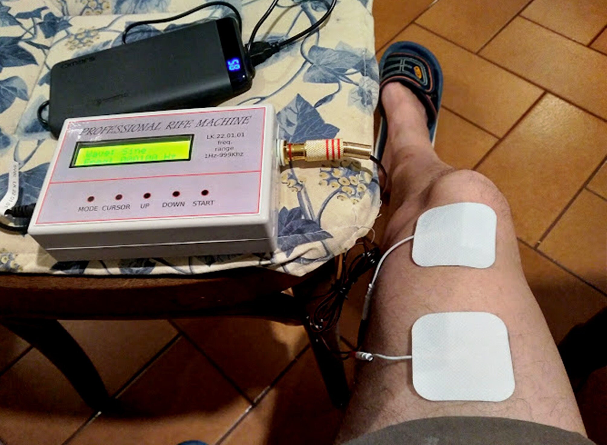 RIFE Machine Hulda Clark's Multi Frequency Zapper Copper Electrodes ...