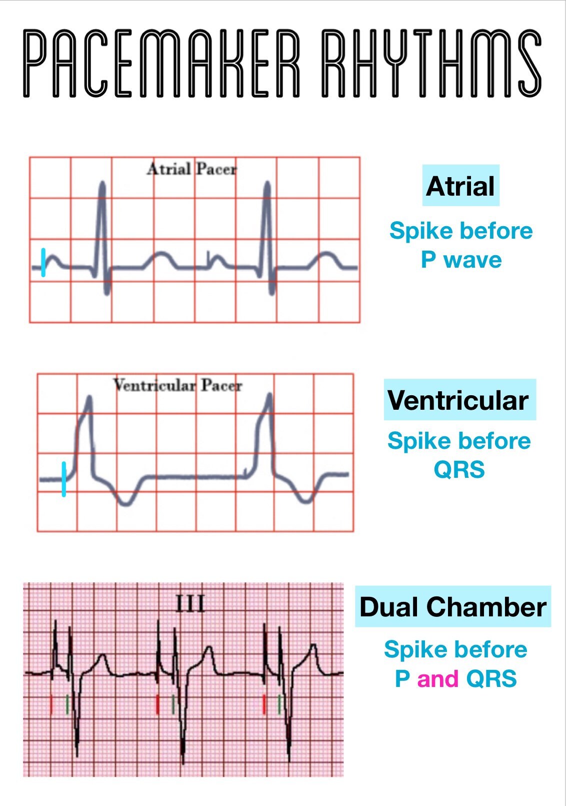 Cardiac strips interpret EKG study guide Digital download | Etsy