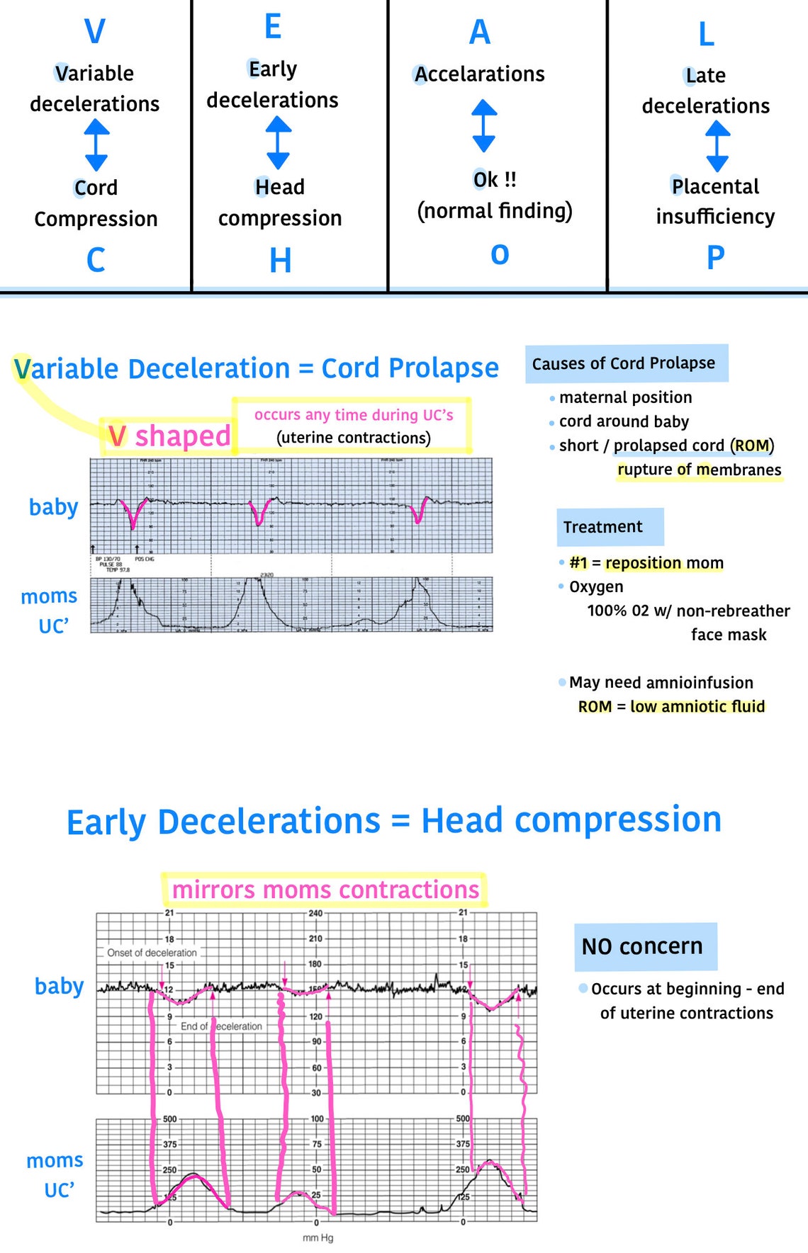 Fetal Heart Rate Interpretation, Fetal Heart Strips, Labor and Delivery ...