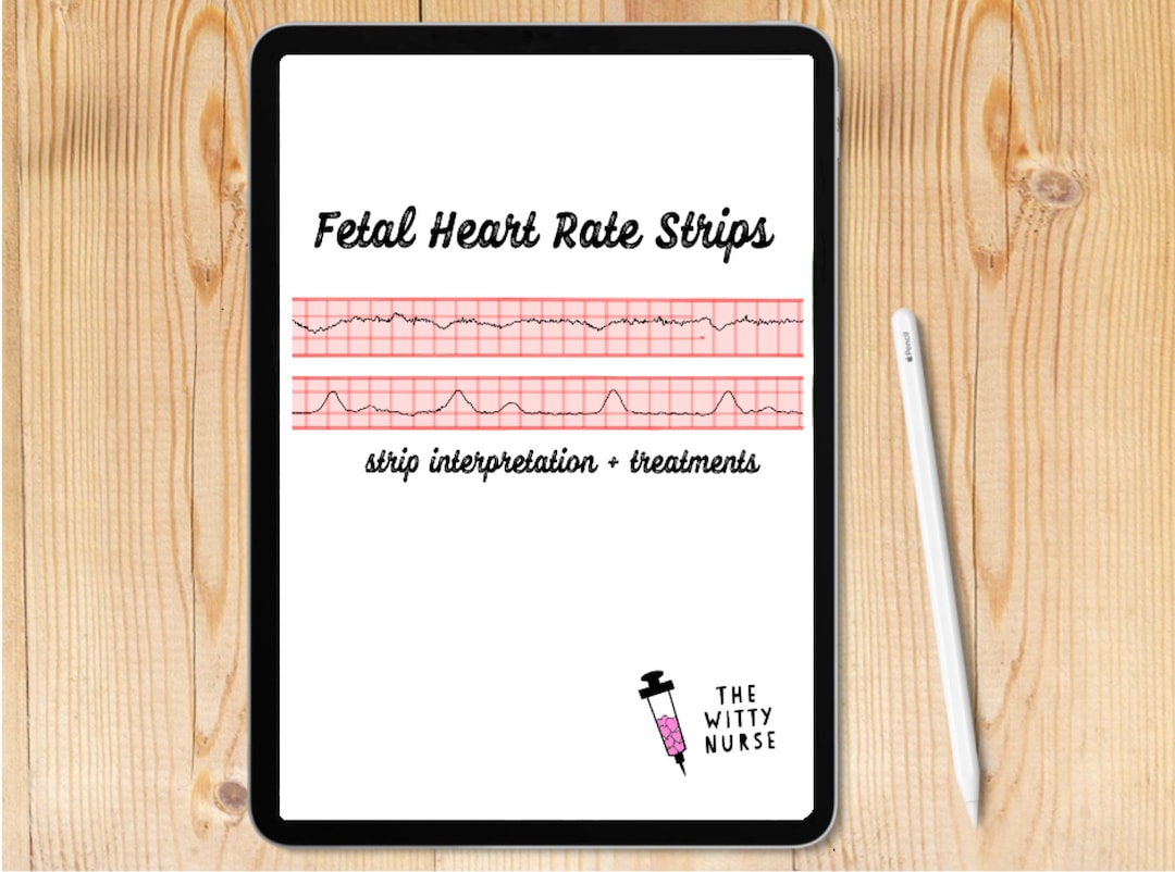 Fetal Heart Rate Interpretation, Fetal Heart Strips, Labor and Delivery ...