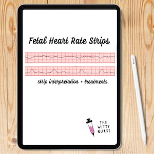 Fetal Heart Rate Interpretation, Fetal Heart Strips, Labor and Delivery ...