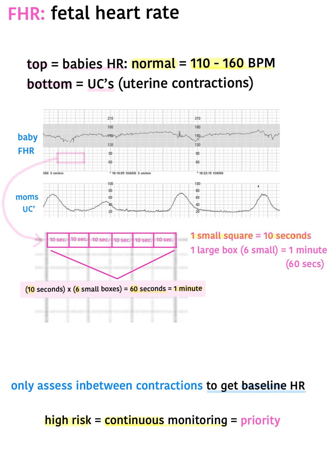 Fetal heart rate strip study guide FHR interpretation | Etsy
