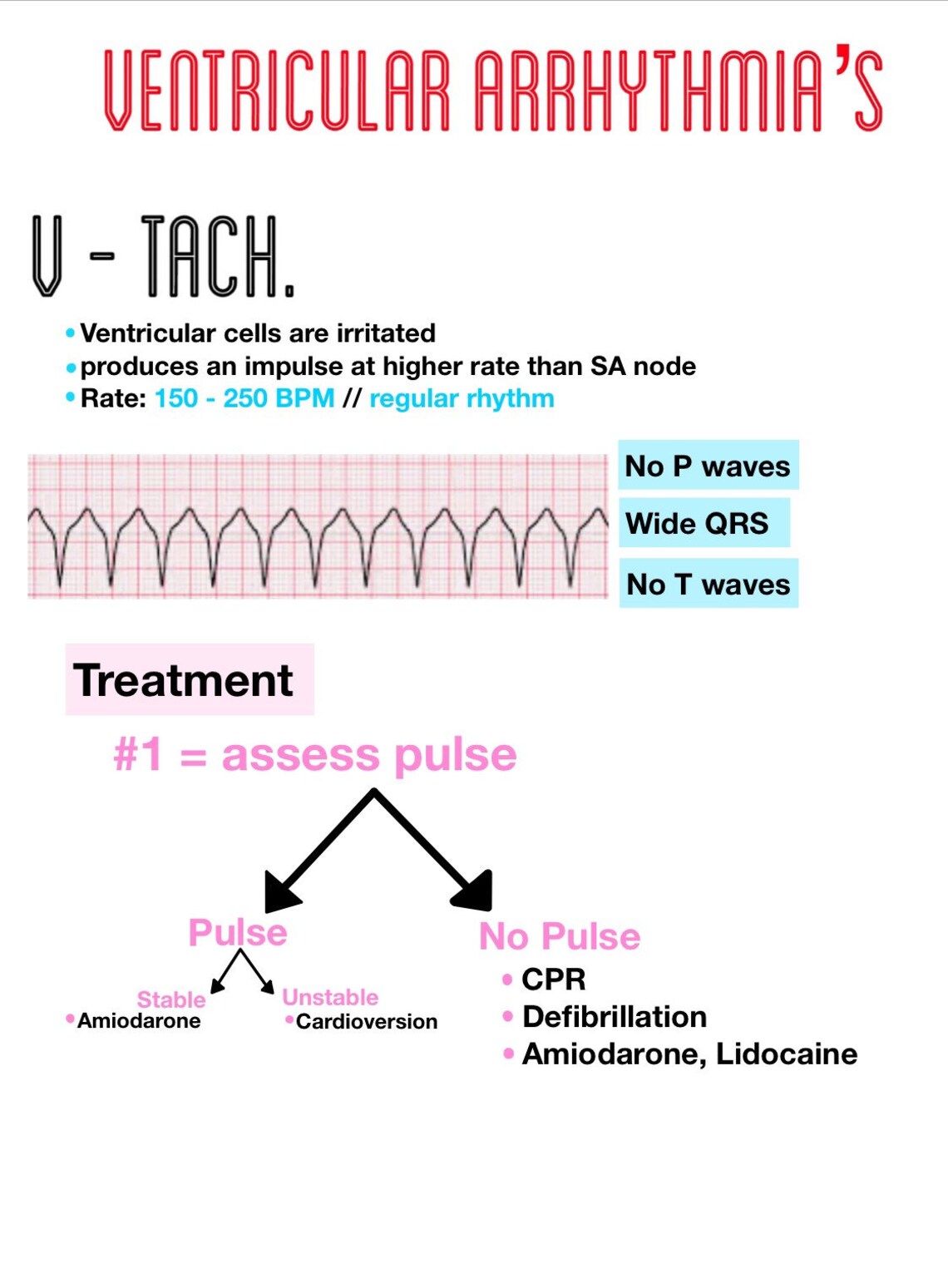 Cardiac strips EKG study guide Digital download | Etsy