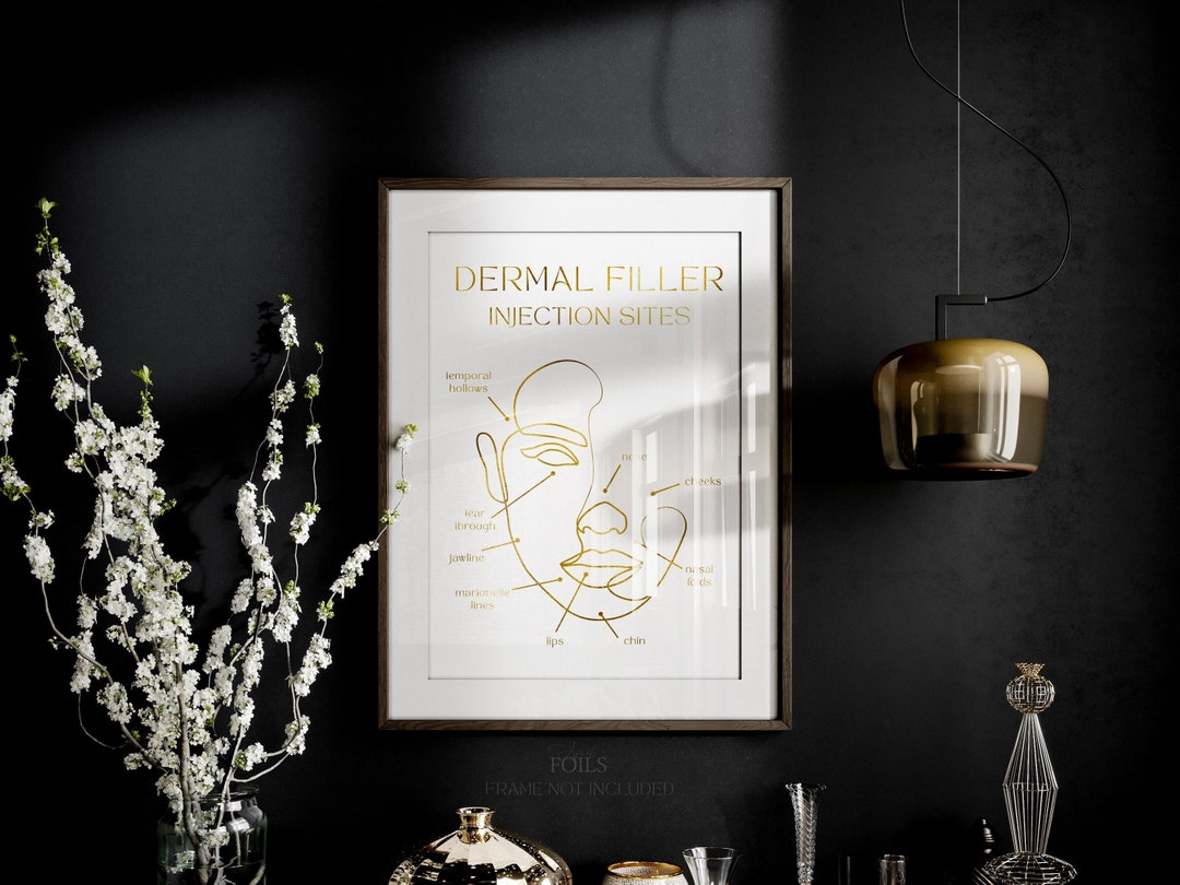 Dermal Filler Injection Sites Print for Aesthetic Clinic Decor, Foil ...