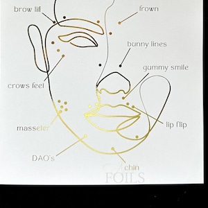 Botox Injection Sites Print for Aesthetics Clinic Decor, Foil Poster ...