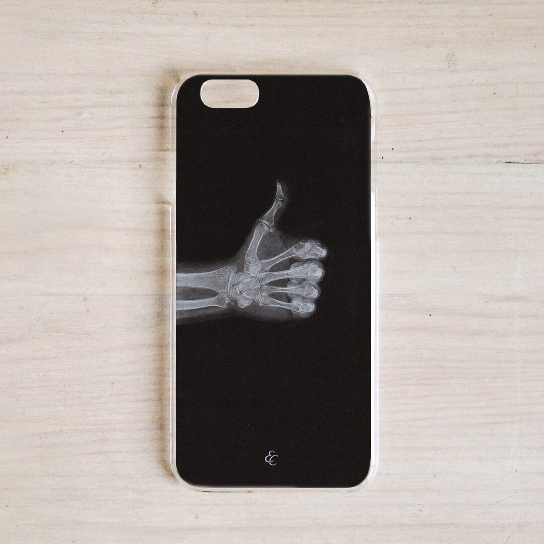 Thumbs up Custom Xray iPhone Case, Samsung Personalized Phone Case Hand ...