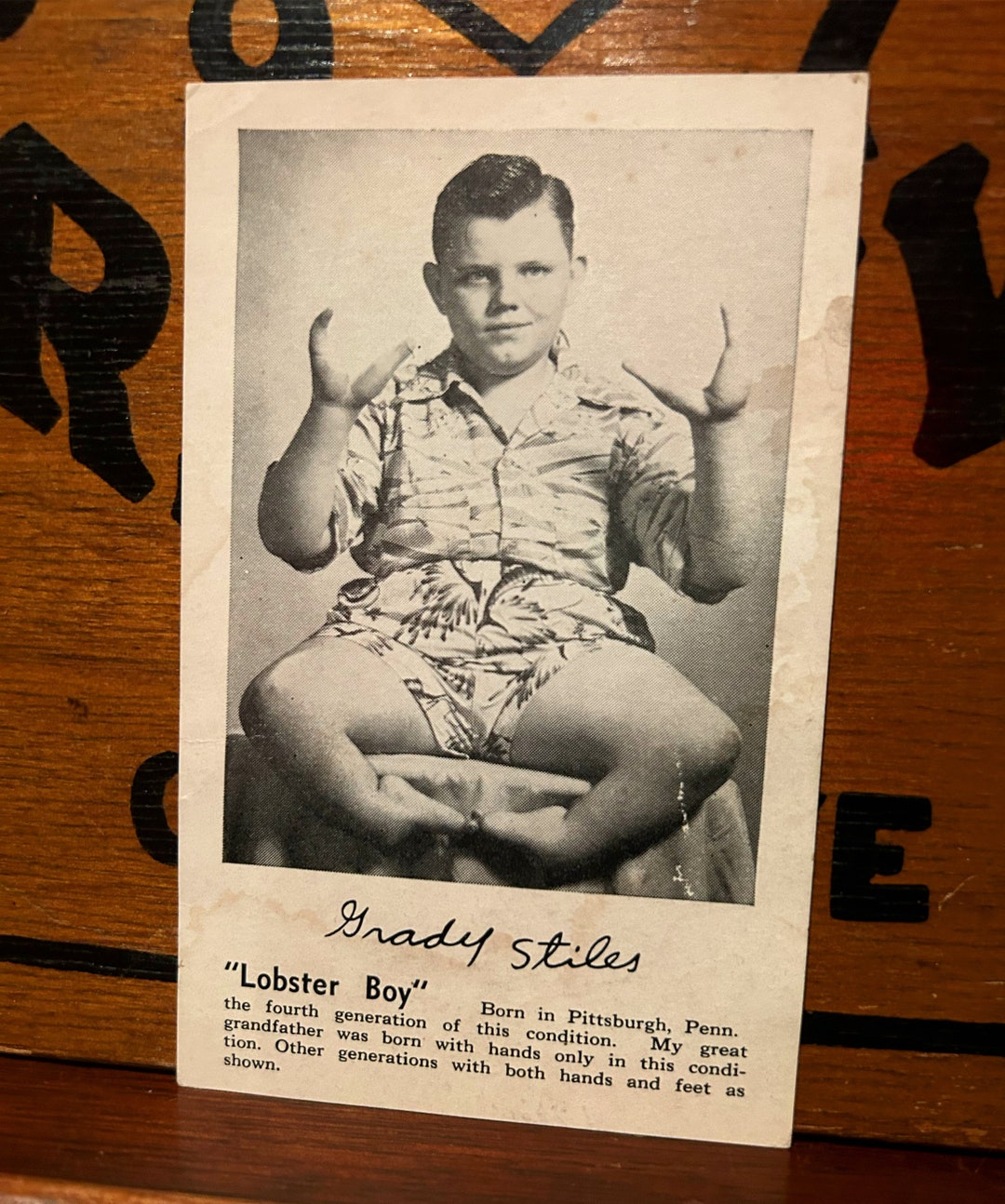 Circa 1950s Pitchcard From the Lobster Boy Grady Stiles Jr - Etsy