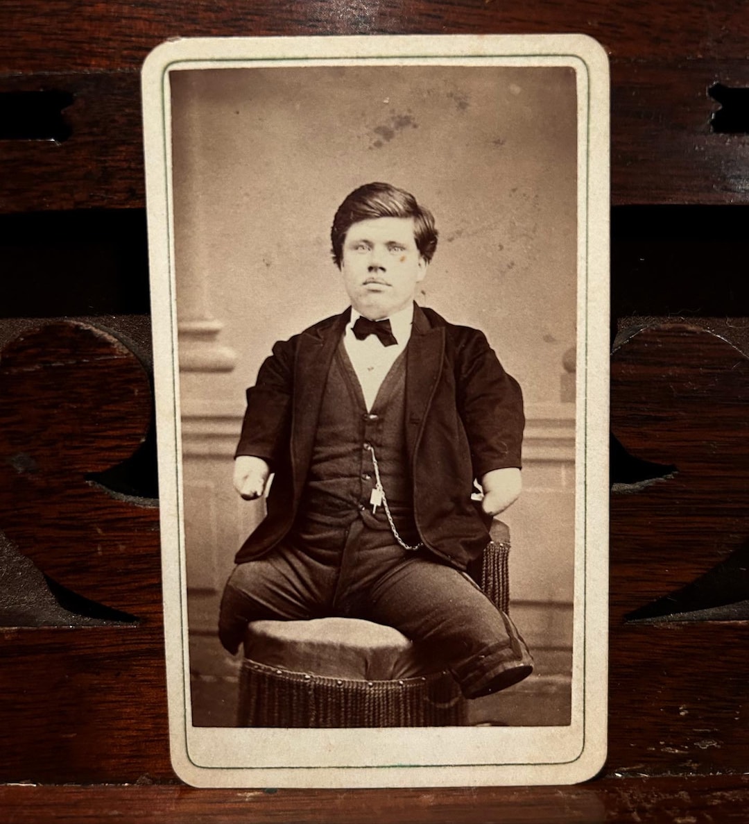 Circa 1870s CDV of Limbless Sideshow Performer Walter H. Stuart - Etsy