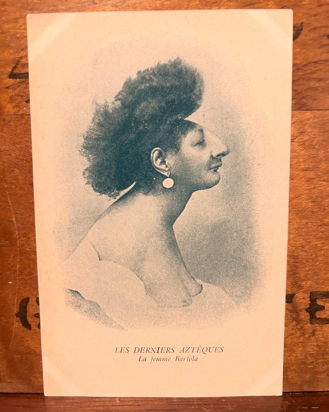 Late 19th Century Postcard From Microcephalic Circus Sideshow Performer ...