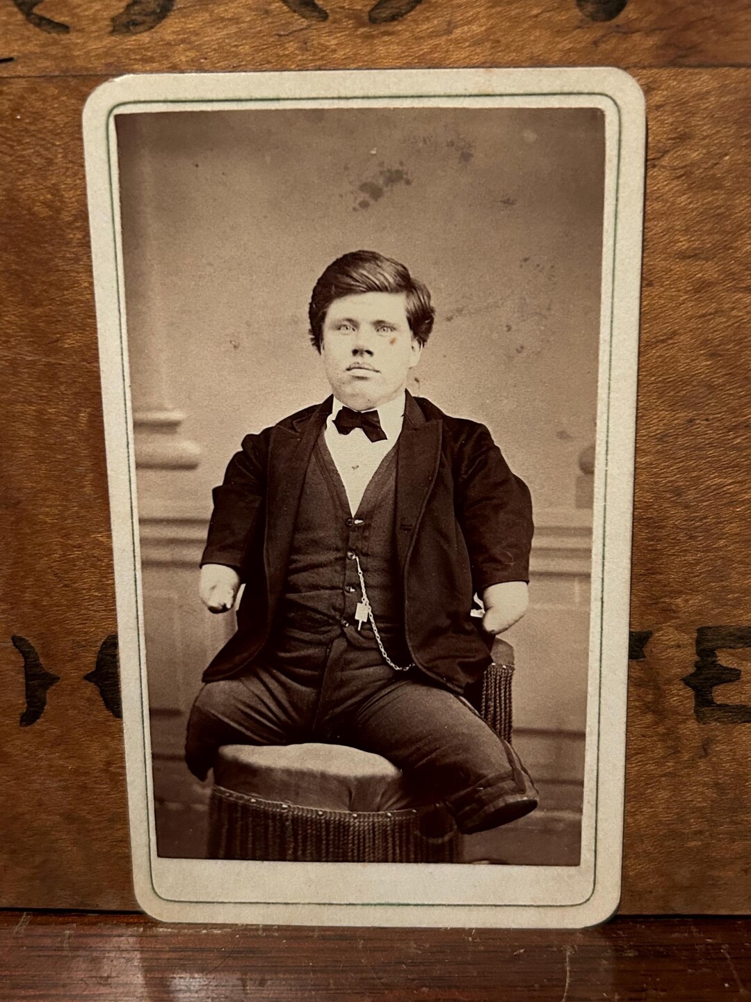 19th Century CDV of Limbless Wonder Sideshow Performer Walter Stuart ...