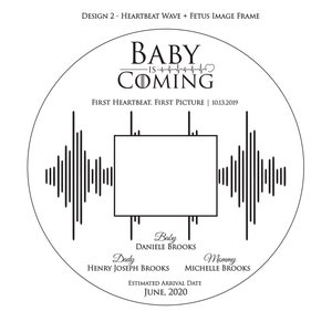 Personalized Engraved First Heartbeat Sound Wave, First Fetus Picture ...