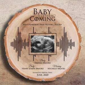 Personalized Engraved First Heartbeat Sound Wave, First Fetus Picture ...