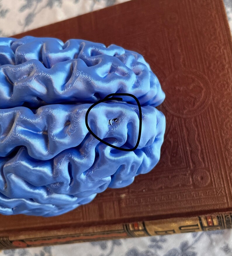 3D Printed Life Size Human Brain – Oops Edition, Minor Imperfections ...