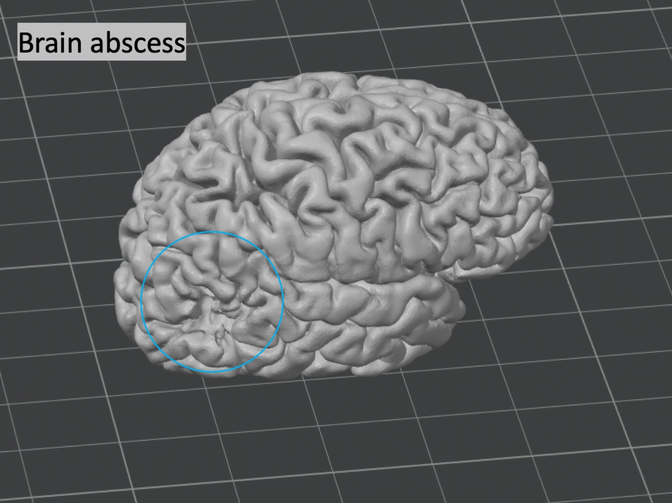 Small 3d-printed Replica of a Unique Human Brain hard PLA - Etsy