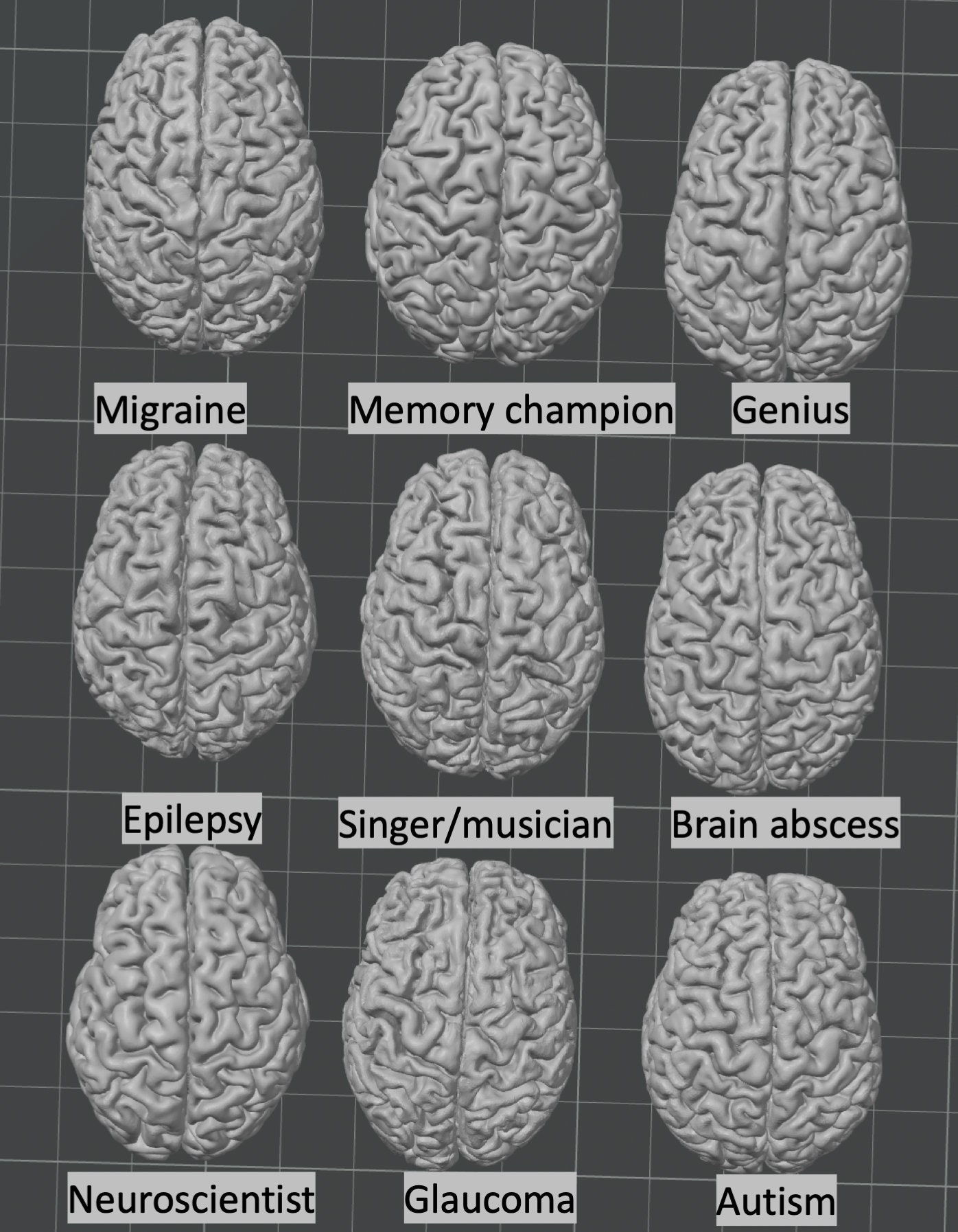 Small 3d-printed Replica of a Unique Human Brain (hard PLA) - Etsy