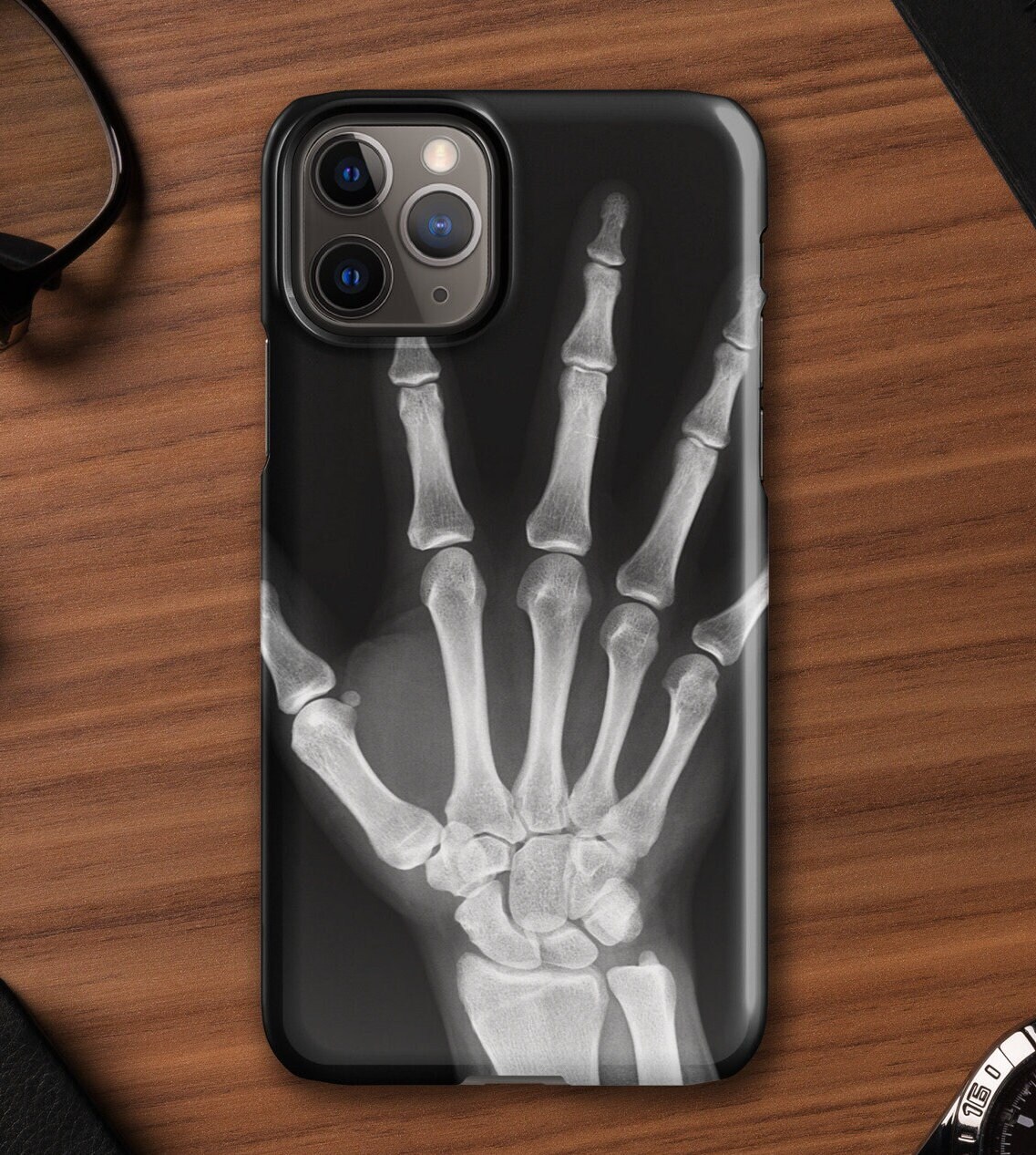 Hand X-ray Snap Case for Iphone® / Radiology Radiography Phone Case ...