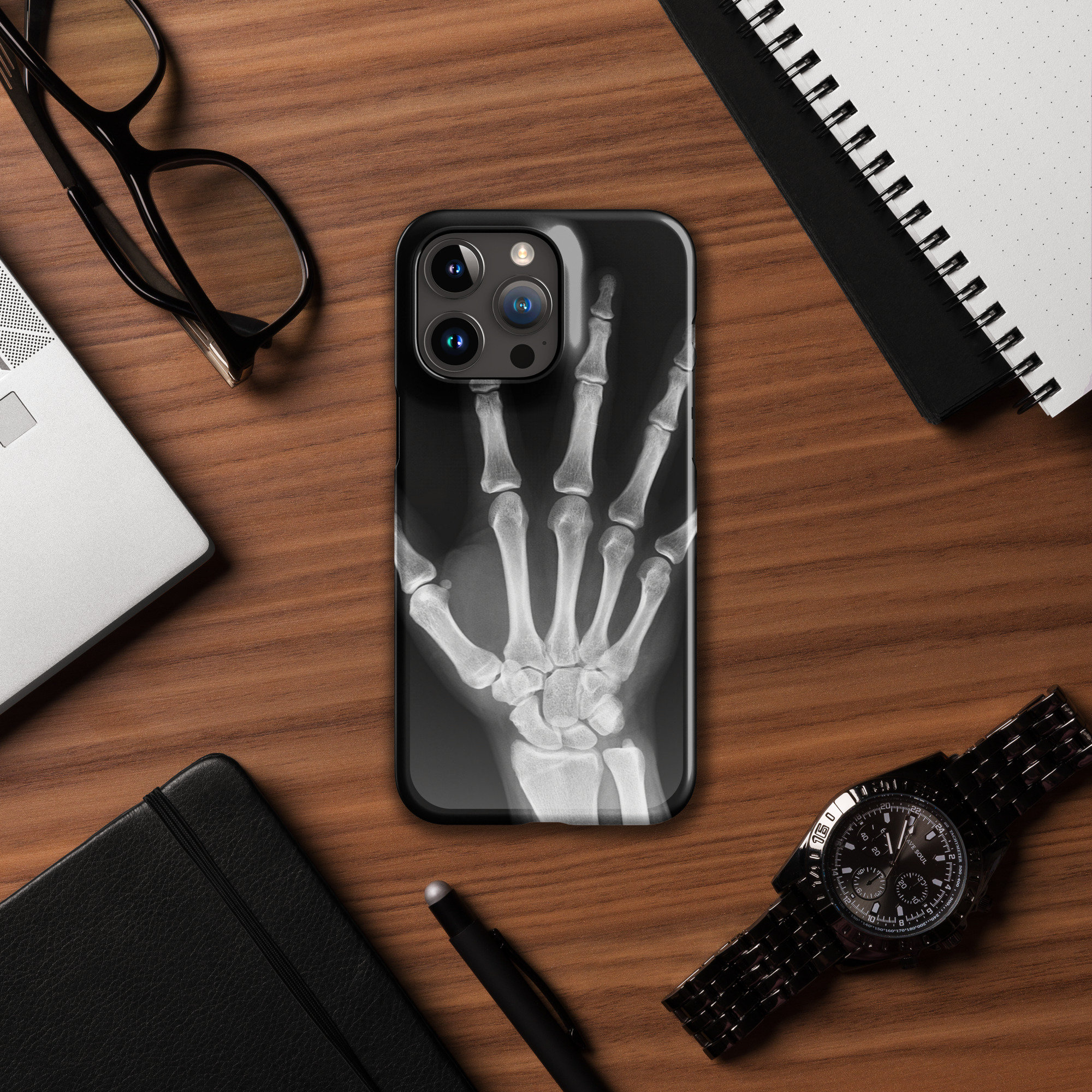 Hand X-ray Snap Case for Iphone® / Radiology Radiography Phone Case ...