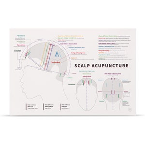 Scalp Acupuncture Print, 2 Size Options, Chinese Medicine, TCM, Frame ...