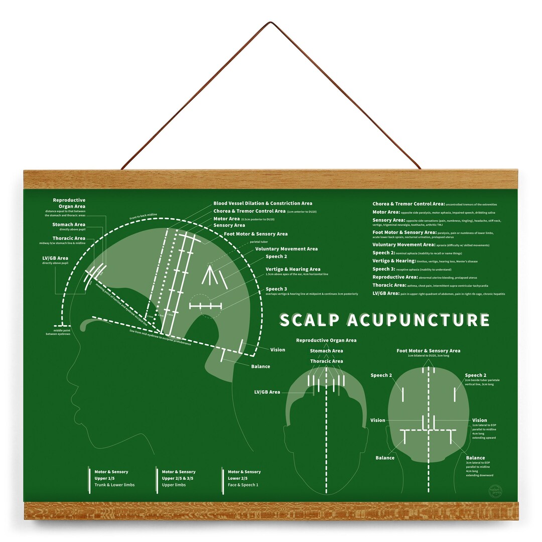 Scalp Acupuncture Print 19" X 13" (green) • Chinese Medicine, TCM ...