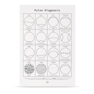 Pulse Diagnosis Print (muted Black) 13” X 19” • Chinese Medicine ...
