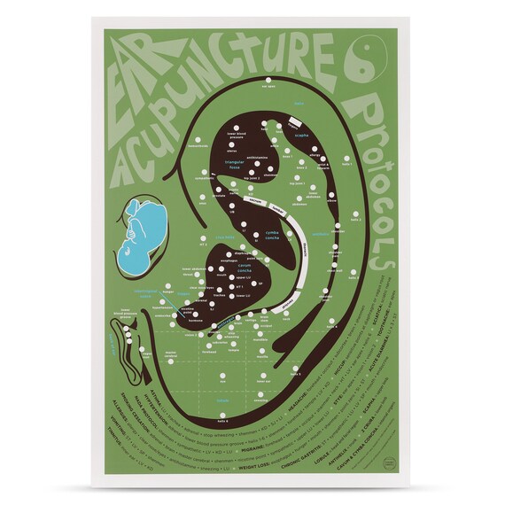 Ear Acupuncture Protocols Print green 13 X 19 - Etsy