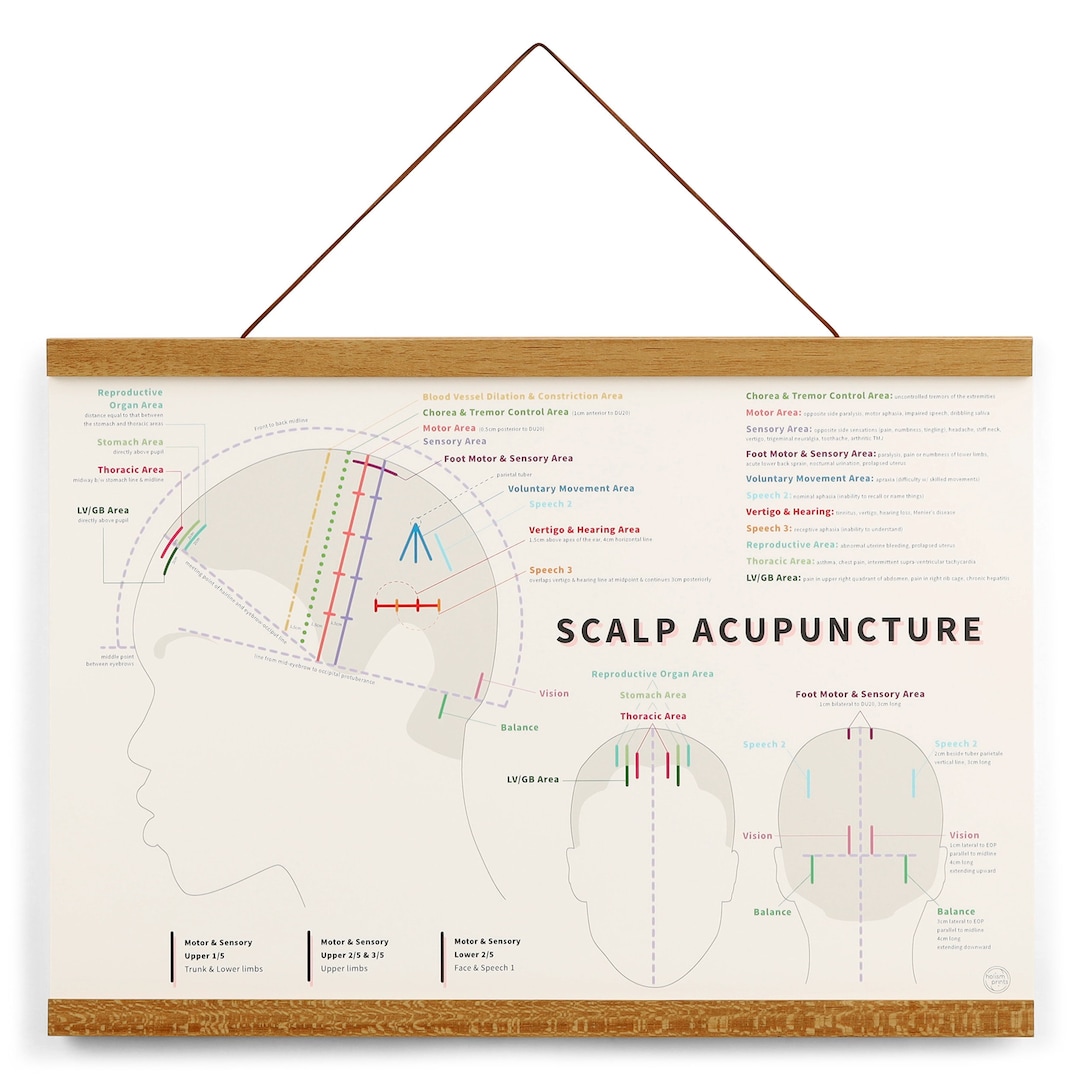 Scalp Acupuncture Print, 2 Size Options, Chinese Medicine, TCM, Frame ...