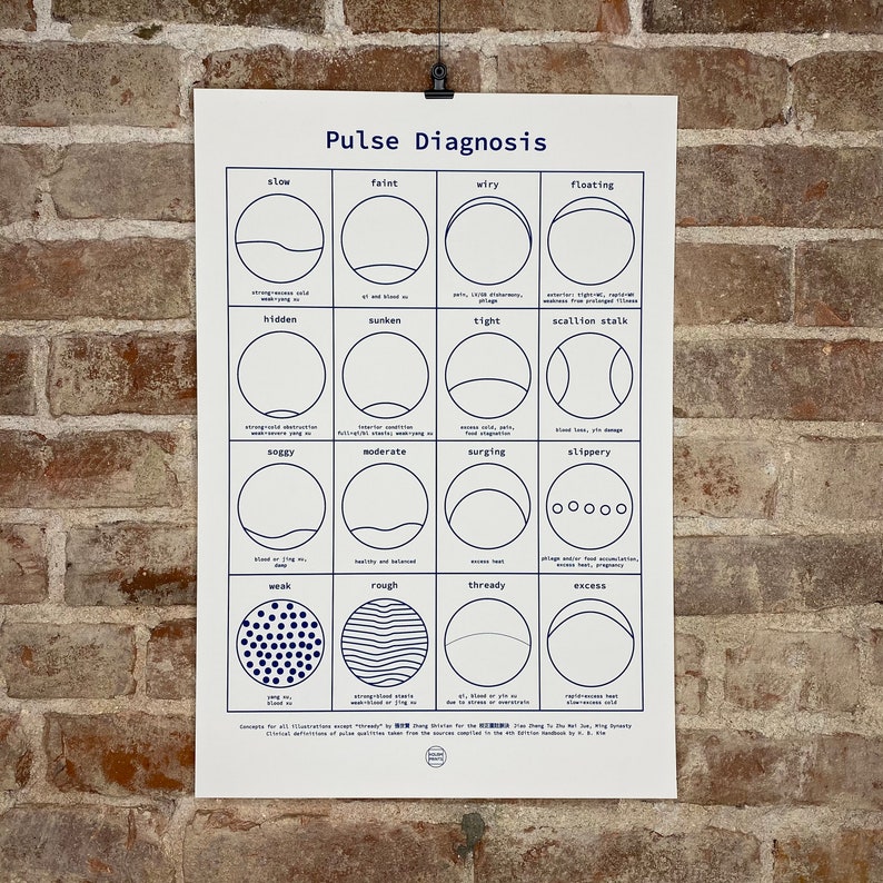 Pulse Diagnosis Print (navy Blue) 13” X 19” • Chinese Medicine ...