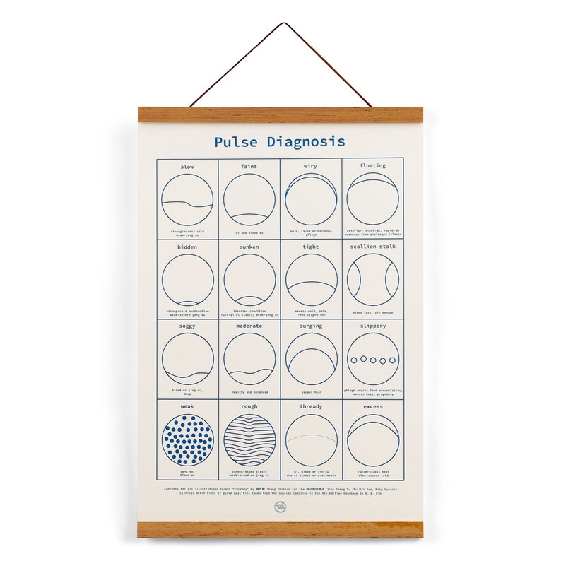 Pulse Diagnosis Print (navy Blue) 13” X 19” • Chinese Medicine ...