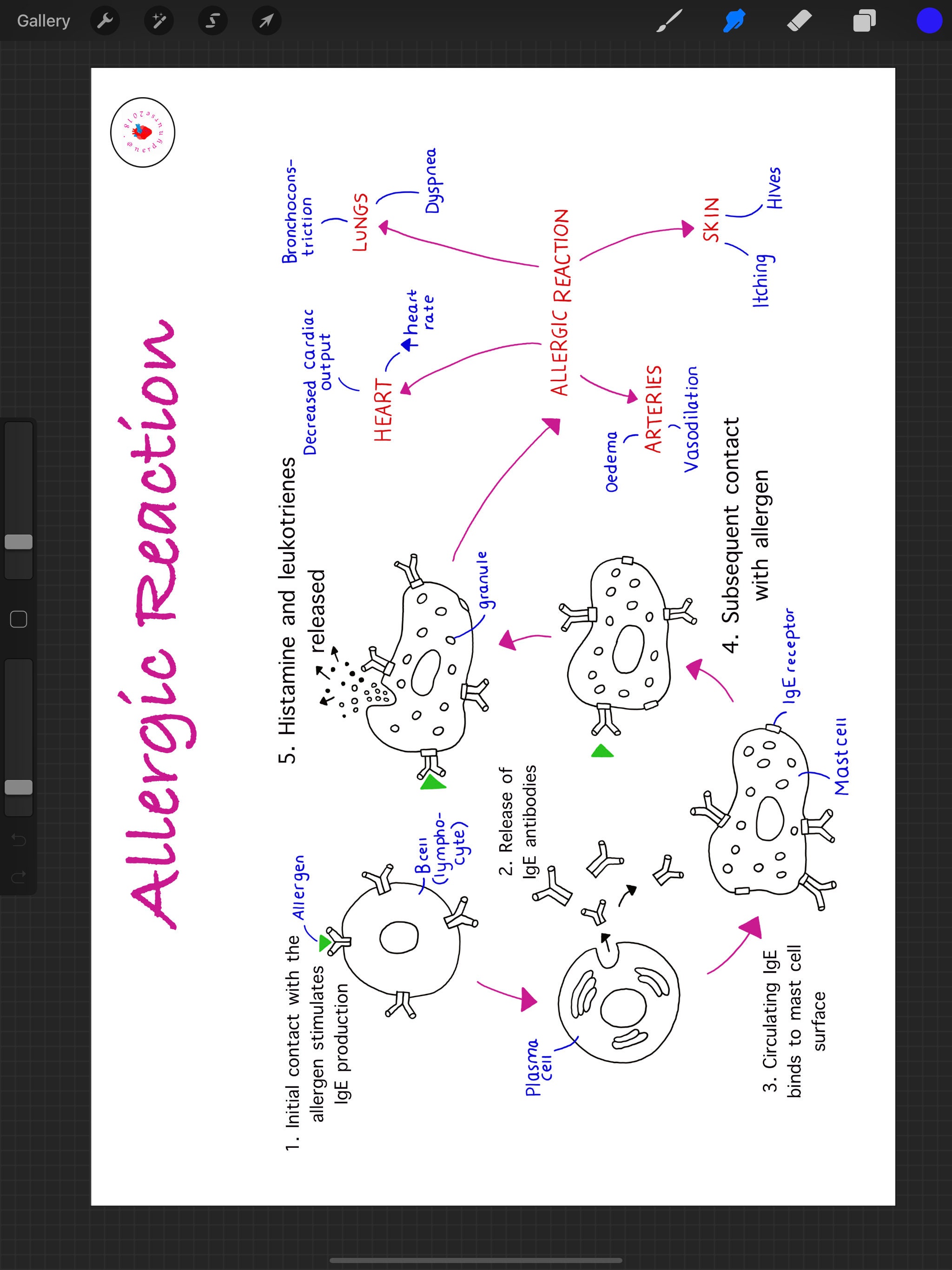 Allergic reaction pathophysiology | Etsy