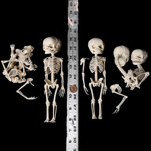 Fetal Skeleton, Skeleton Lot, Replica Skeleton, Human Bones, Replica ...