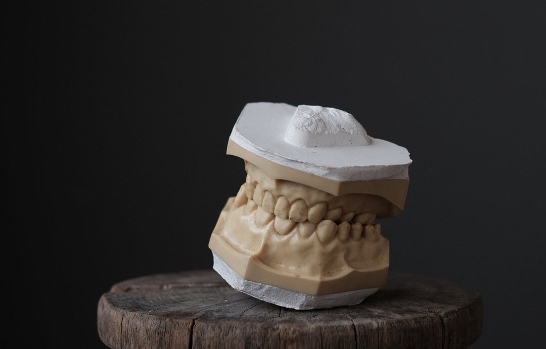 Japanese Vintage Dental Mold, Shop Display, Dental Model - Etsy