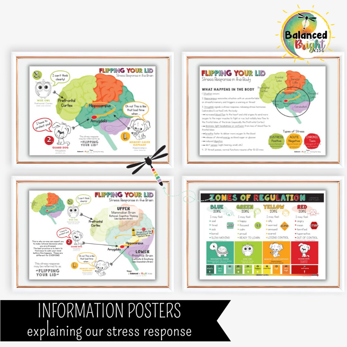 Flipping Your Lid - Stress Response: Classroom Management, Kids, Self ...